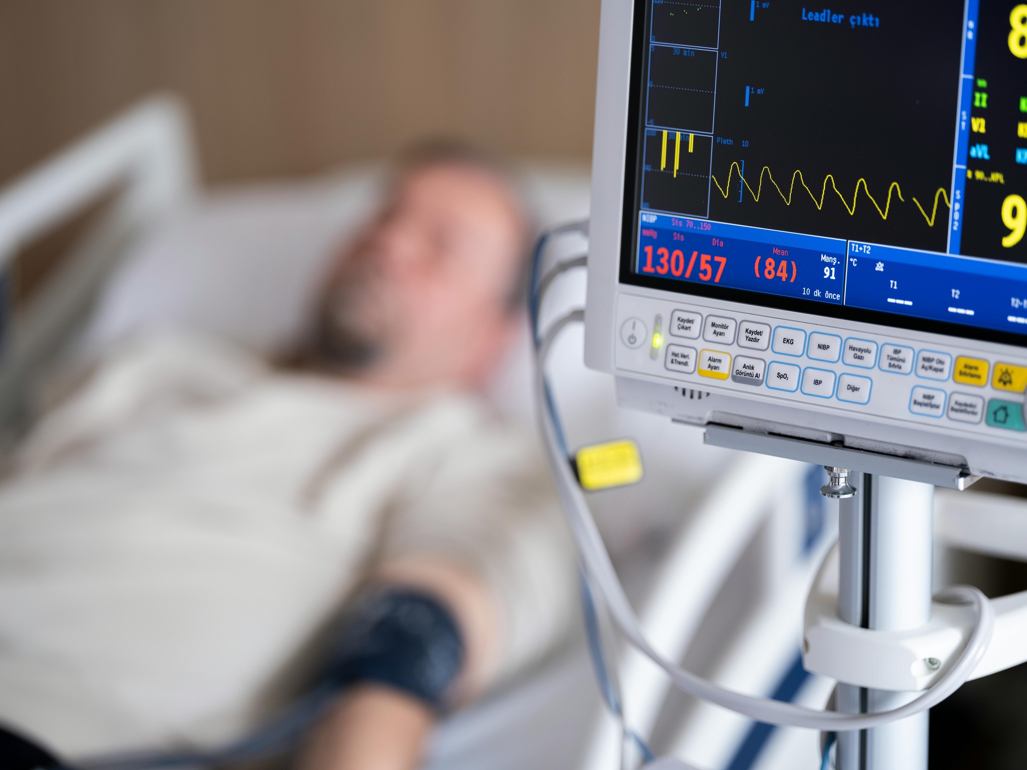 How Is a Stress Echocardiogram Performed and What Should I Expect ...